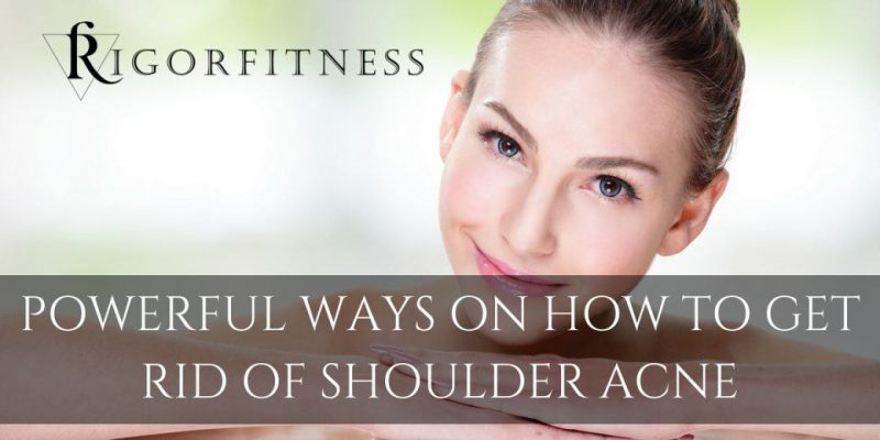 Powerful Ways On How To Get Rid Of Shoulder Acne - Rigor Fitness: Fat ...